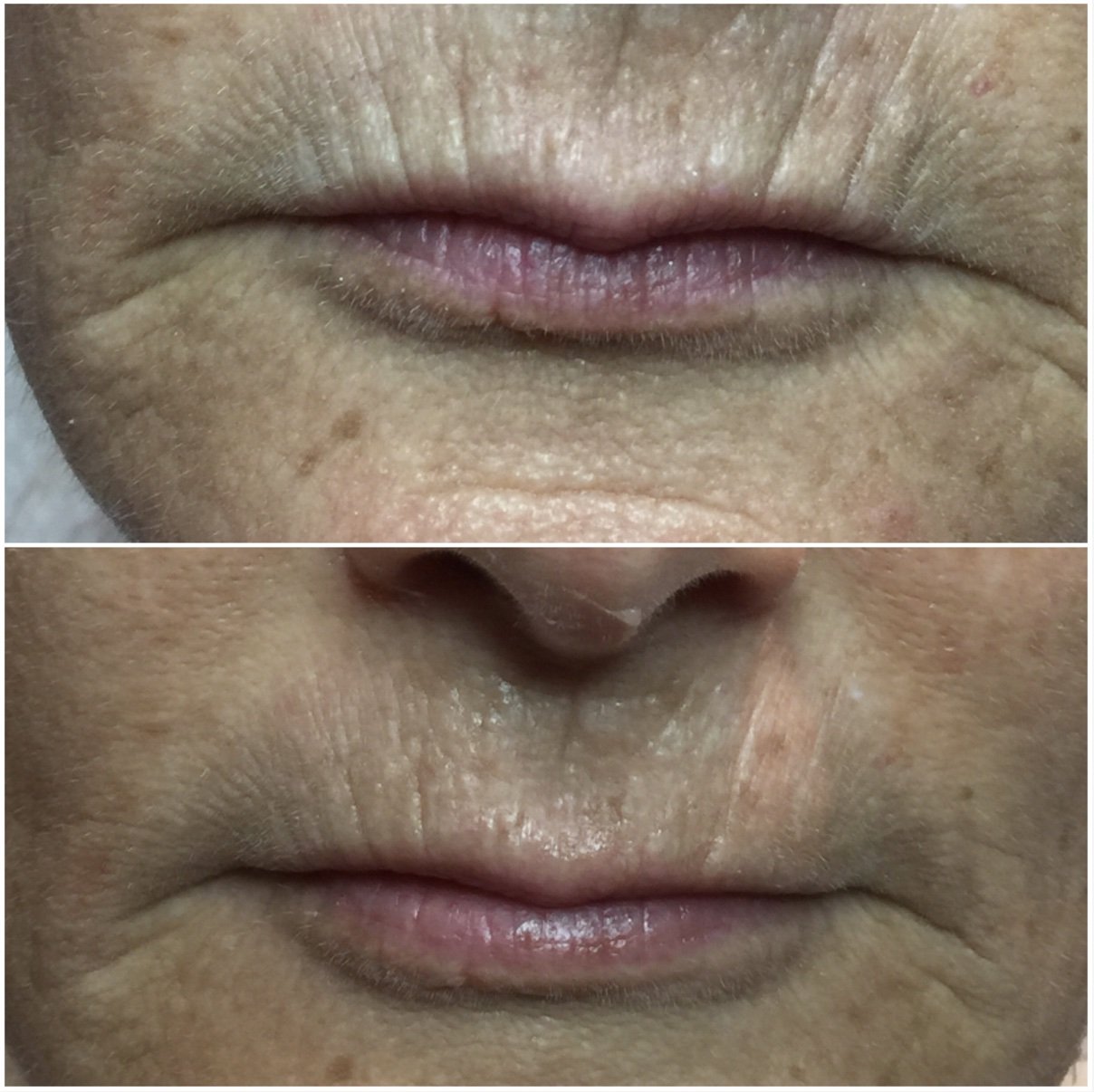 CO2 Lift Pro Mask Trio