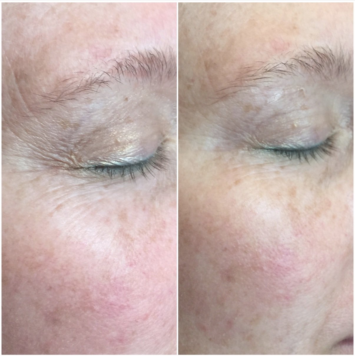 CO2 Lift Pro Mask Trio